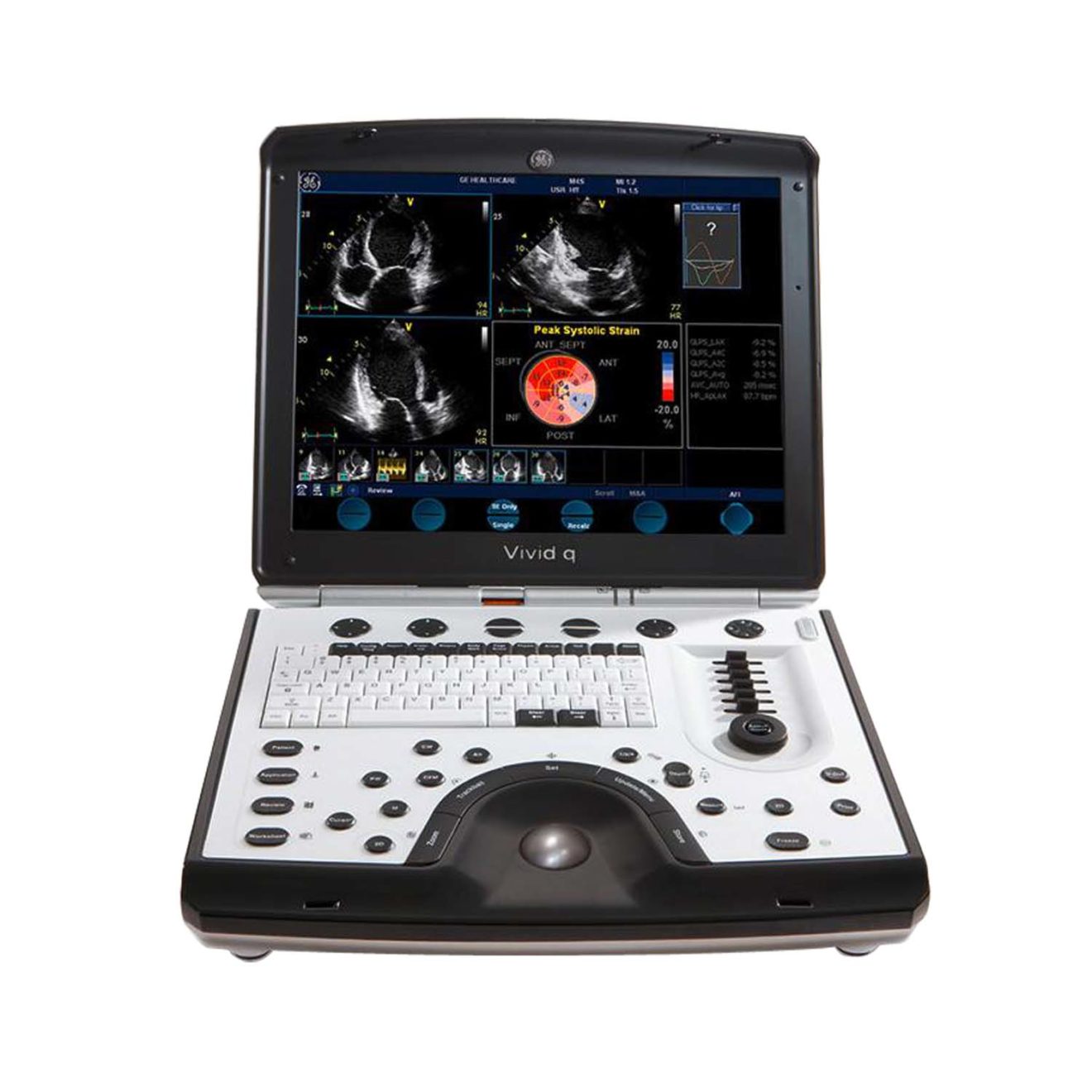 GE Vivid Q Cardiovascular Ultrasound System | Global Med Systems